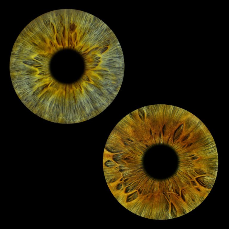 Simulateur d'Effets pour Photos d'Iris - You&Eye