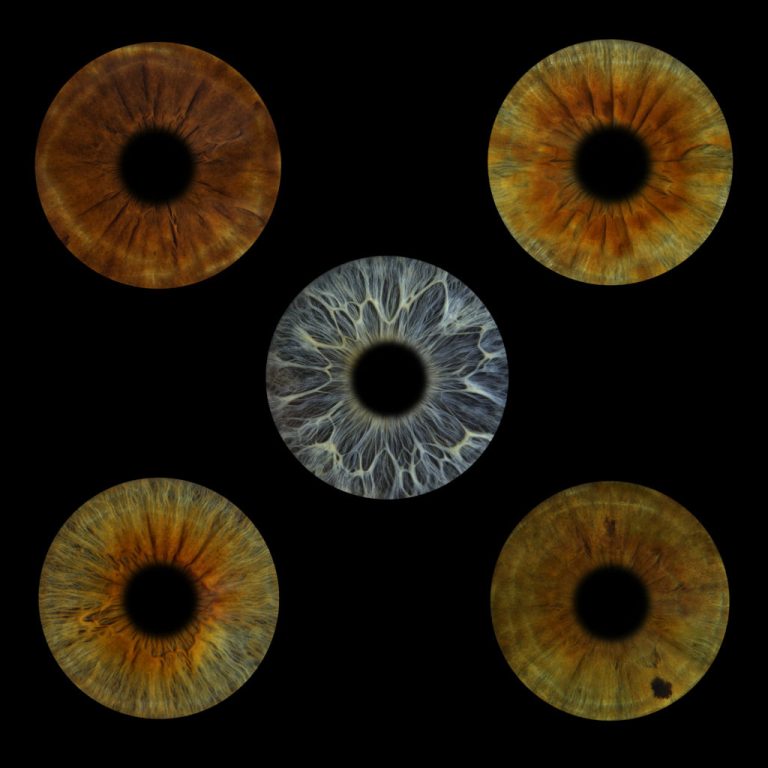 You&Eye - Photographie de l'iris