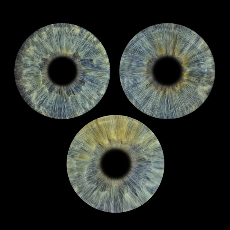 You&Eye - Photographie de l'iris